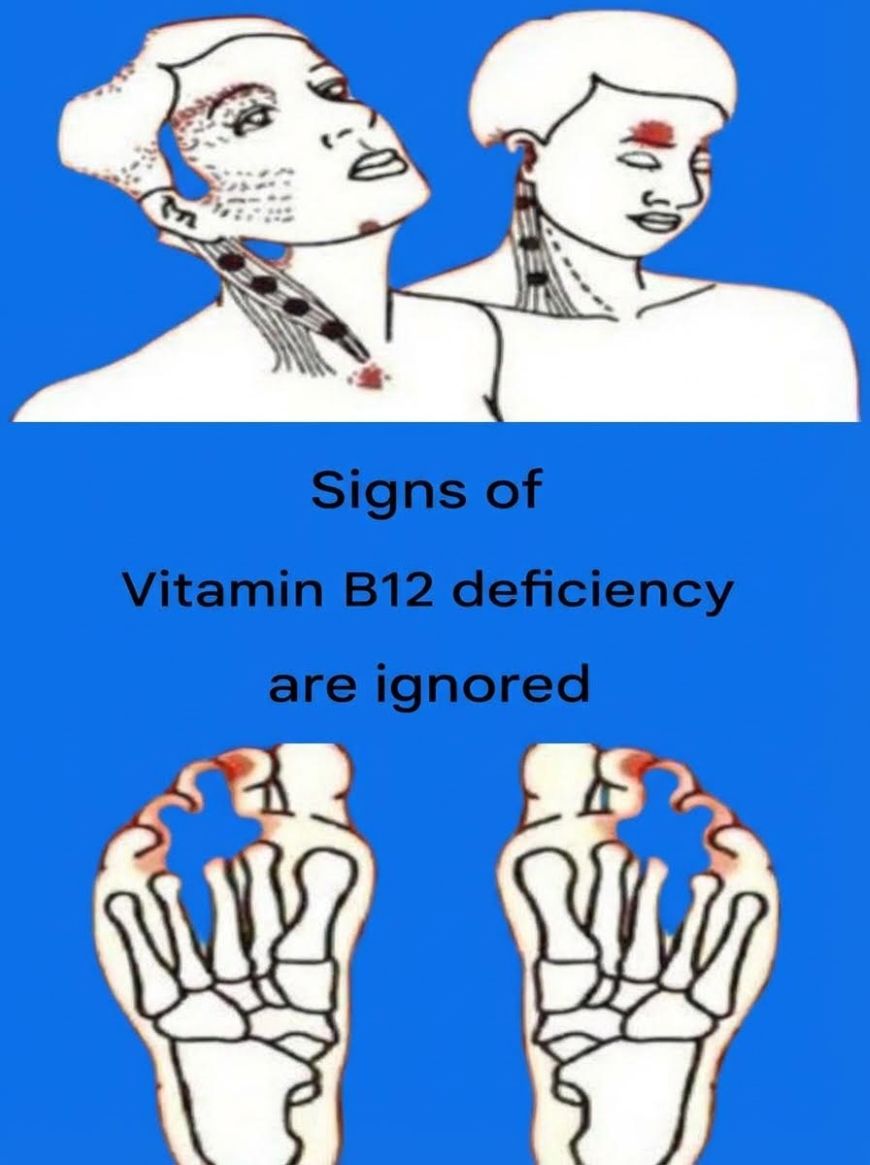 Recognizing the Early Signs of Low Vitamin B12 Levels – Topsdecor.com